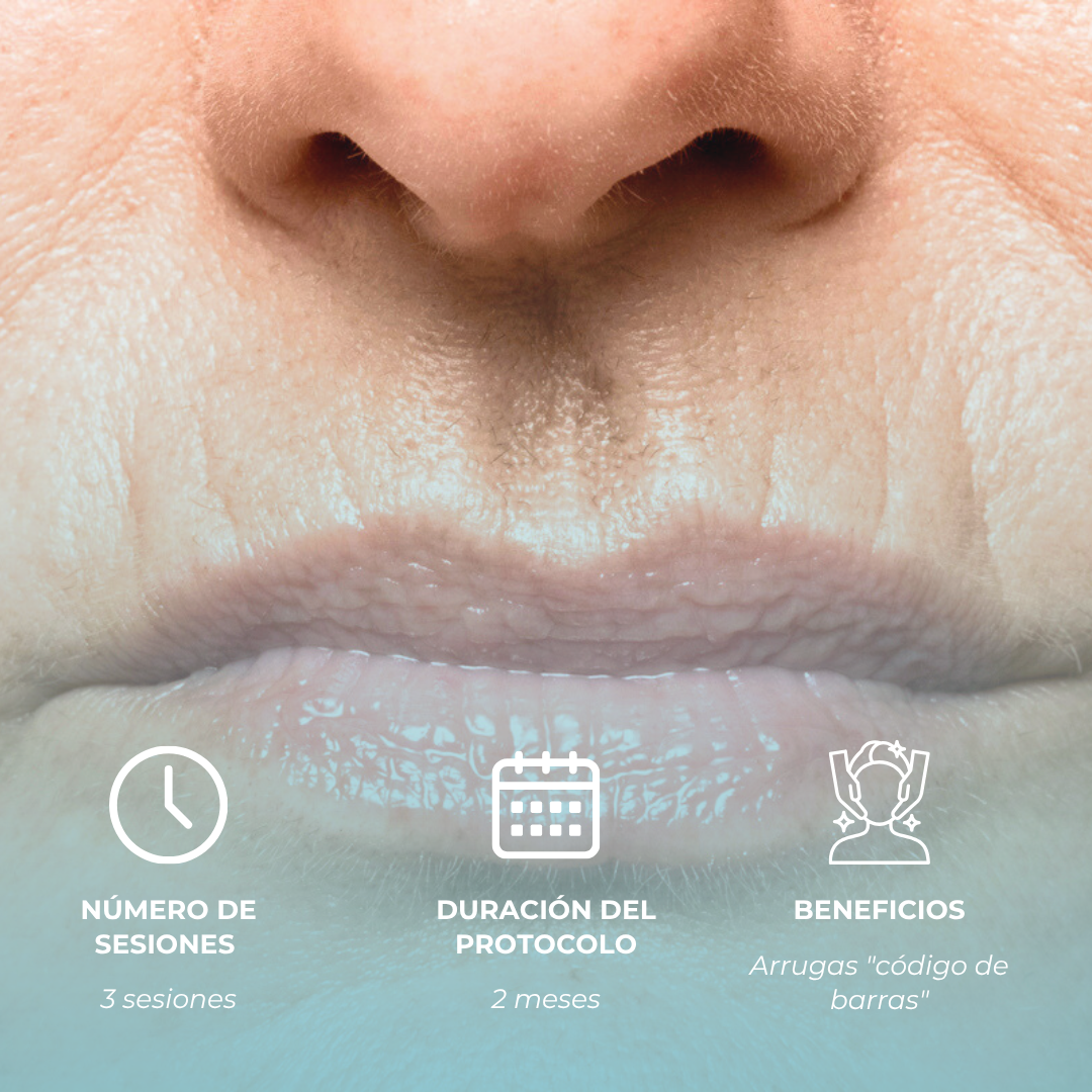 Regeneración Peribucal – Clínicas Dr. Román
